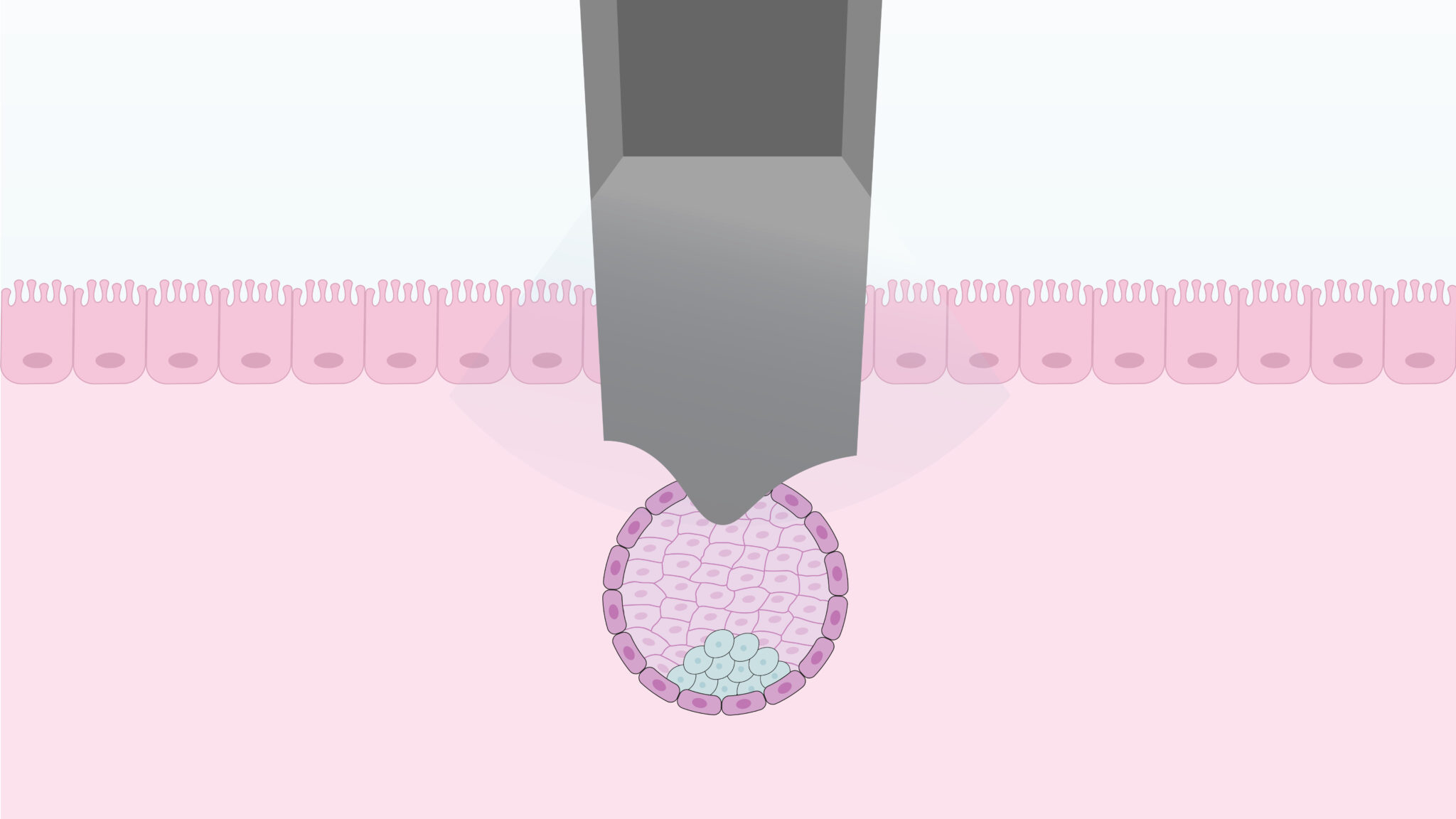 Engineering Implantation: Redefining Embryo Transfer